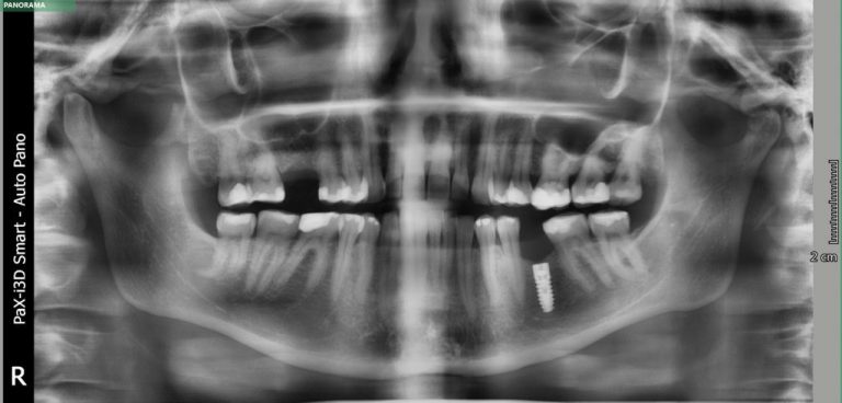 Dental Scans – A & D Dental Practice & Laboratory | Nottingham ...